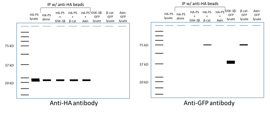 Solved You have evidence that the presinilin (PS) protein | Chegg.com