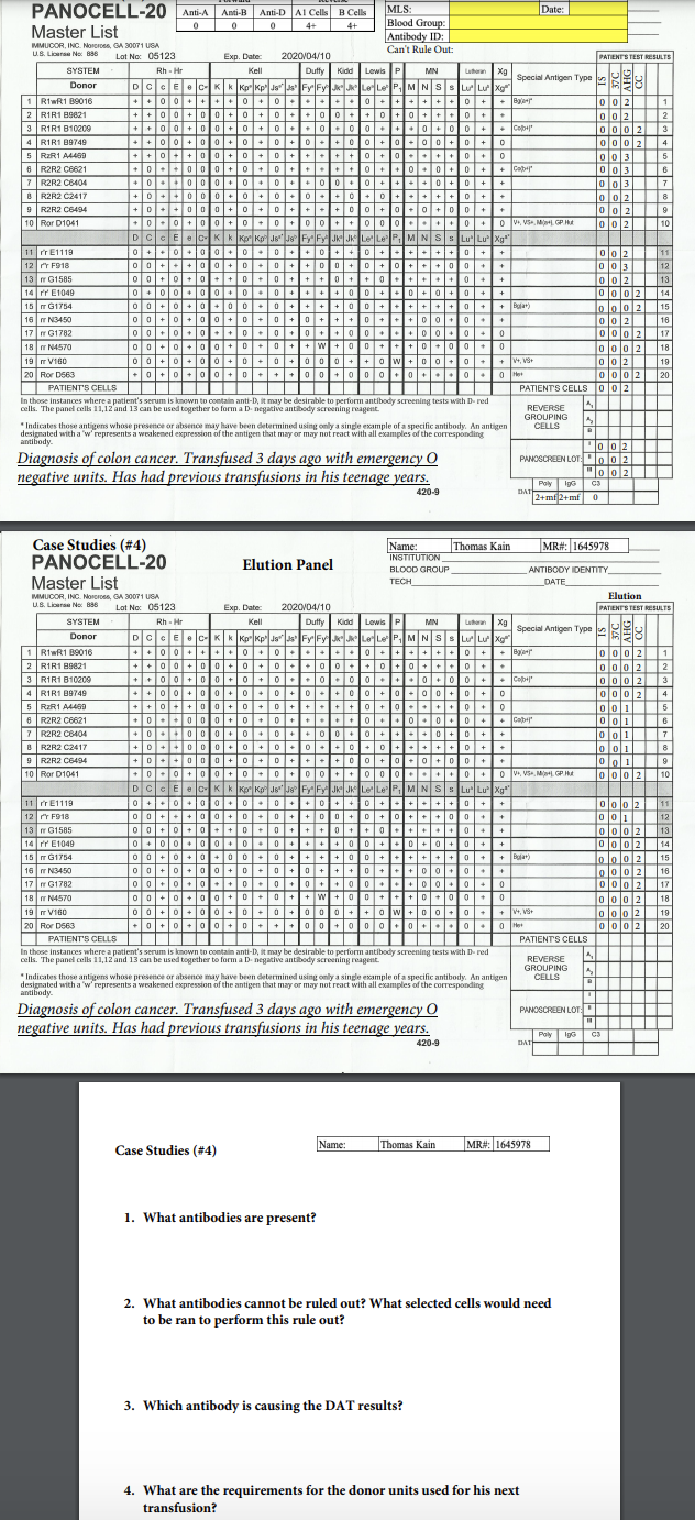 Solved MN + PANOCELL-20 Anti-A Anti-B Anti-D Al Cells B | Chegg.com