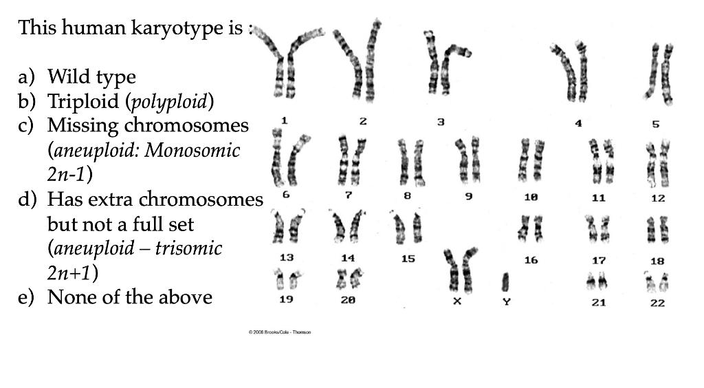 Solved This human karyotype is Ir 3 a) Wild type b) Triploid | Chegg.com