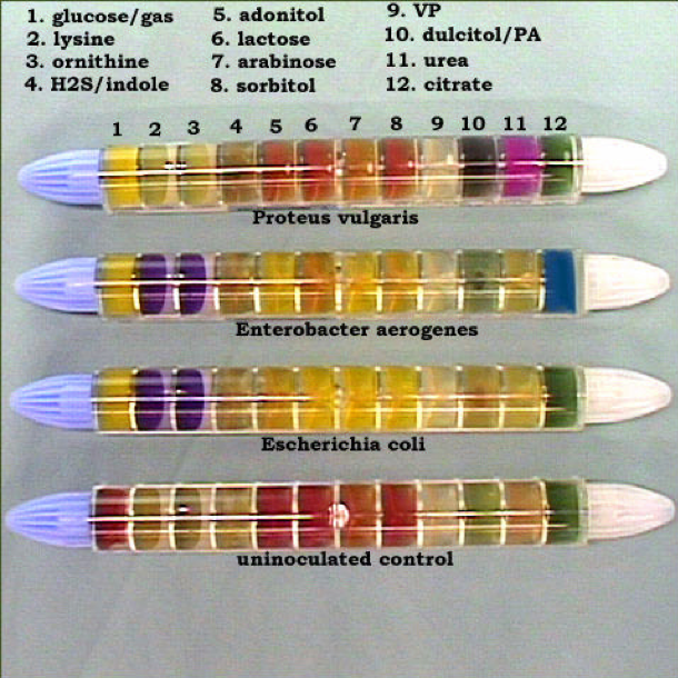 Solved Enterotube (basically the same as Enteropluri). See | Chegg.com