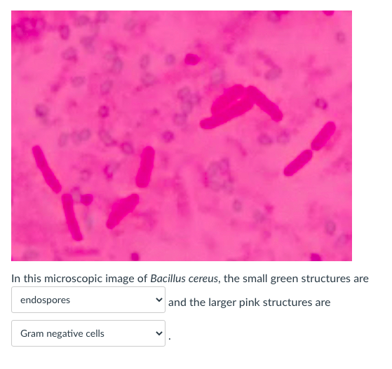 Solved In this microscopic image of Bacillus cereus, the | Chegg.com