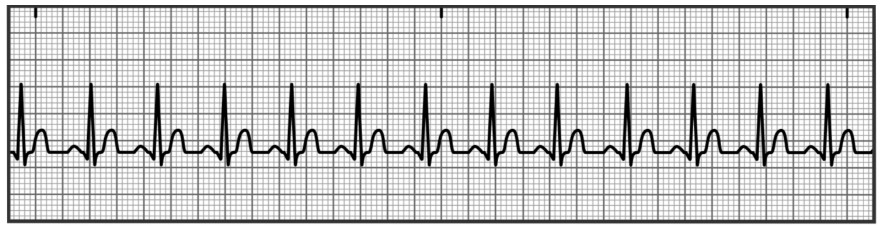 Solved 8. What is the heart rate of the EKG tracing? A. 180 | Chegg.com