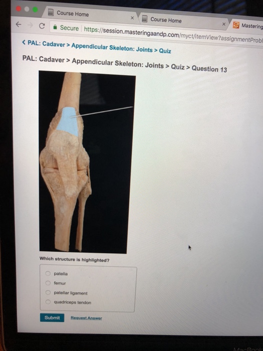L: Cadaver> Appendicular Skeleton: Joints> Quiz > | Chegg.com