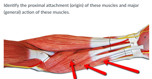 Solved Identify the proximal attachment (origin) of these | Chegg.com
