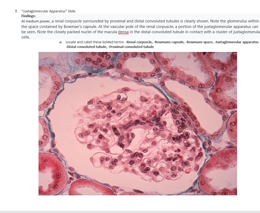 Solved I. "Renal Cortex"- Slide Findings: In this low power | Chegg.com