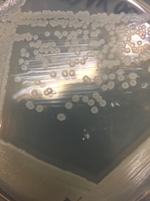 Solved So basically this is a TSA plate the first plate has | Chegg.com