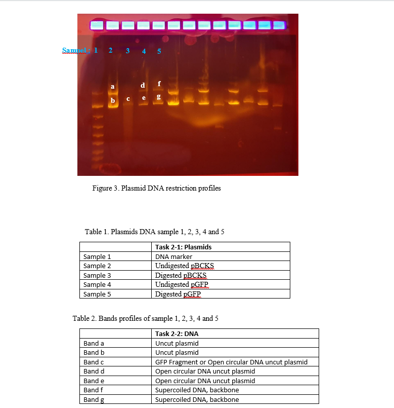 Solved Figure 3. Plasmid DNA restriction profiles Table 1. | Chegg.com