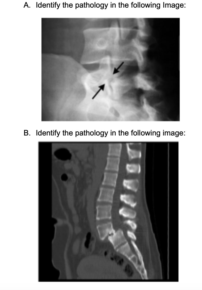 A. Identify the pathology in the following Image: B. | Chegg.com