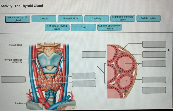 Solved Activity: The Thyroid Gland Isthmus of thyroid gland | Chegg.com