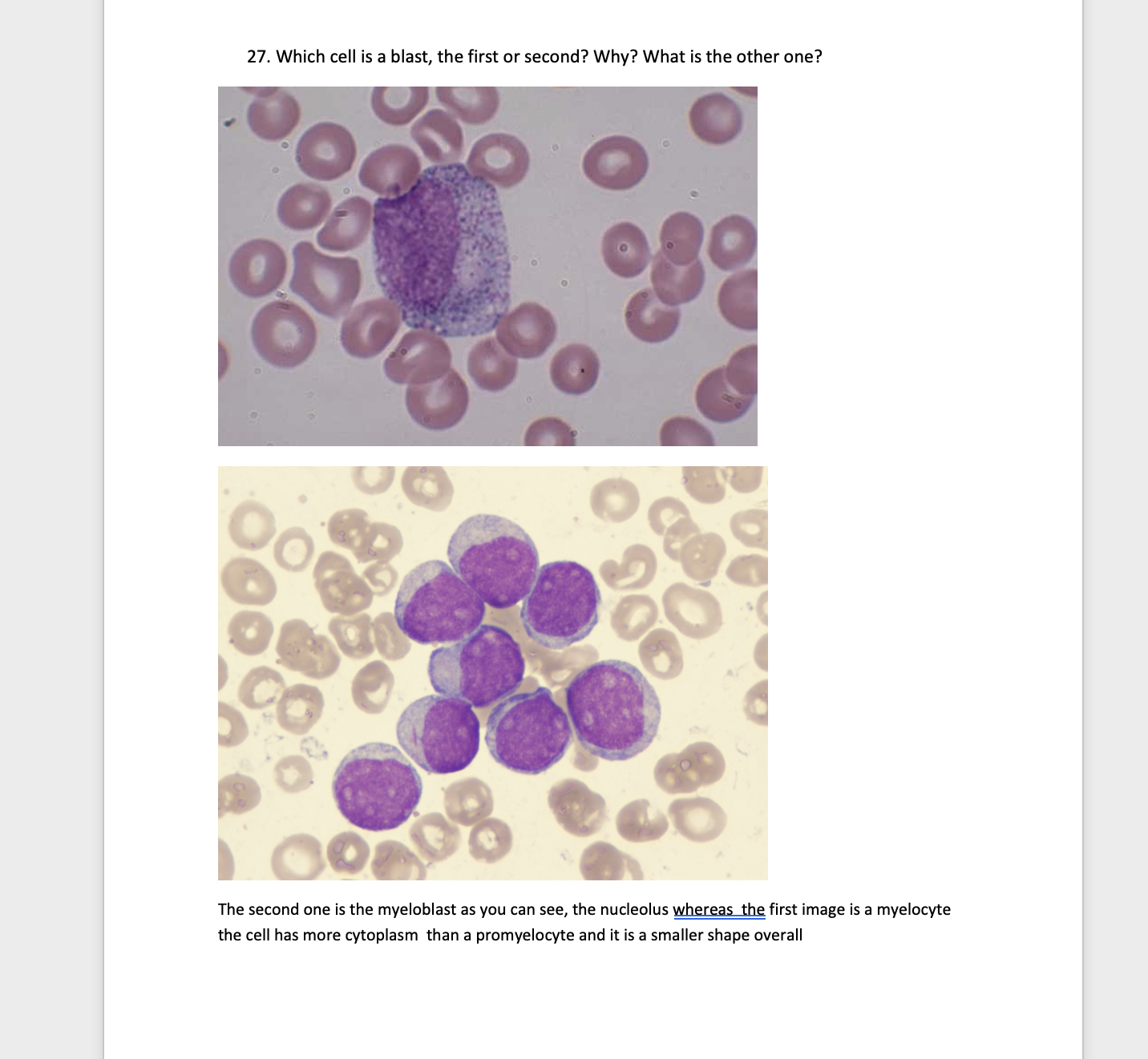 Solved Metamyelocyte- ﻿color of cytoplasm and granule | Chegg.com