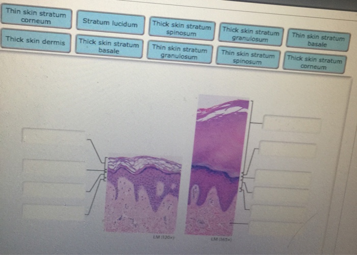 Solved Thin skin stratum Stratum lucidum Thick skin stratum | Chegg.com