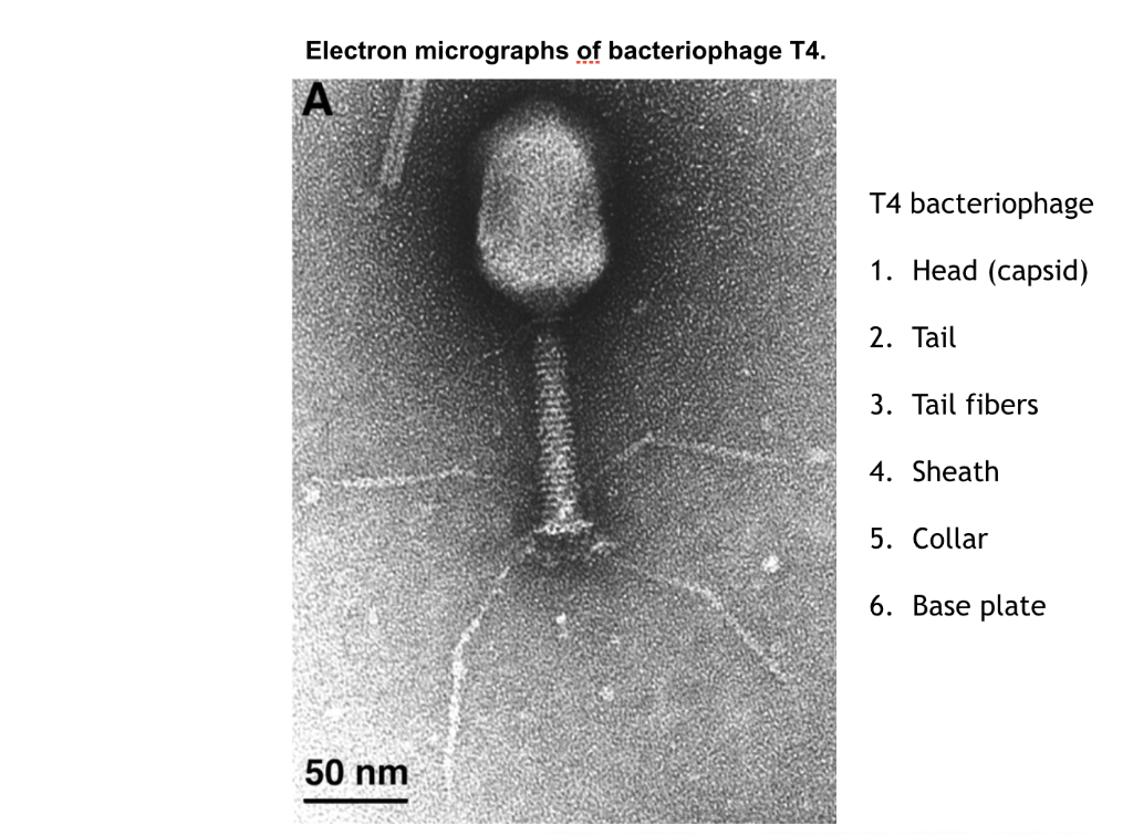 Solved Identify structures in the EM micrographs Match the | Chegg.com