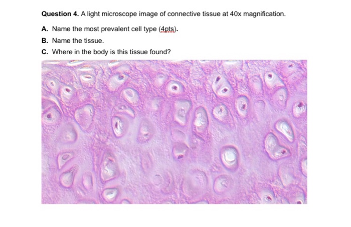 Solved Question 4. A light microscope image of connective | Chegg.com