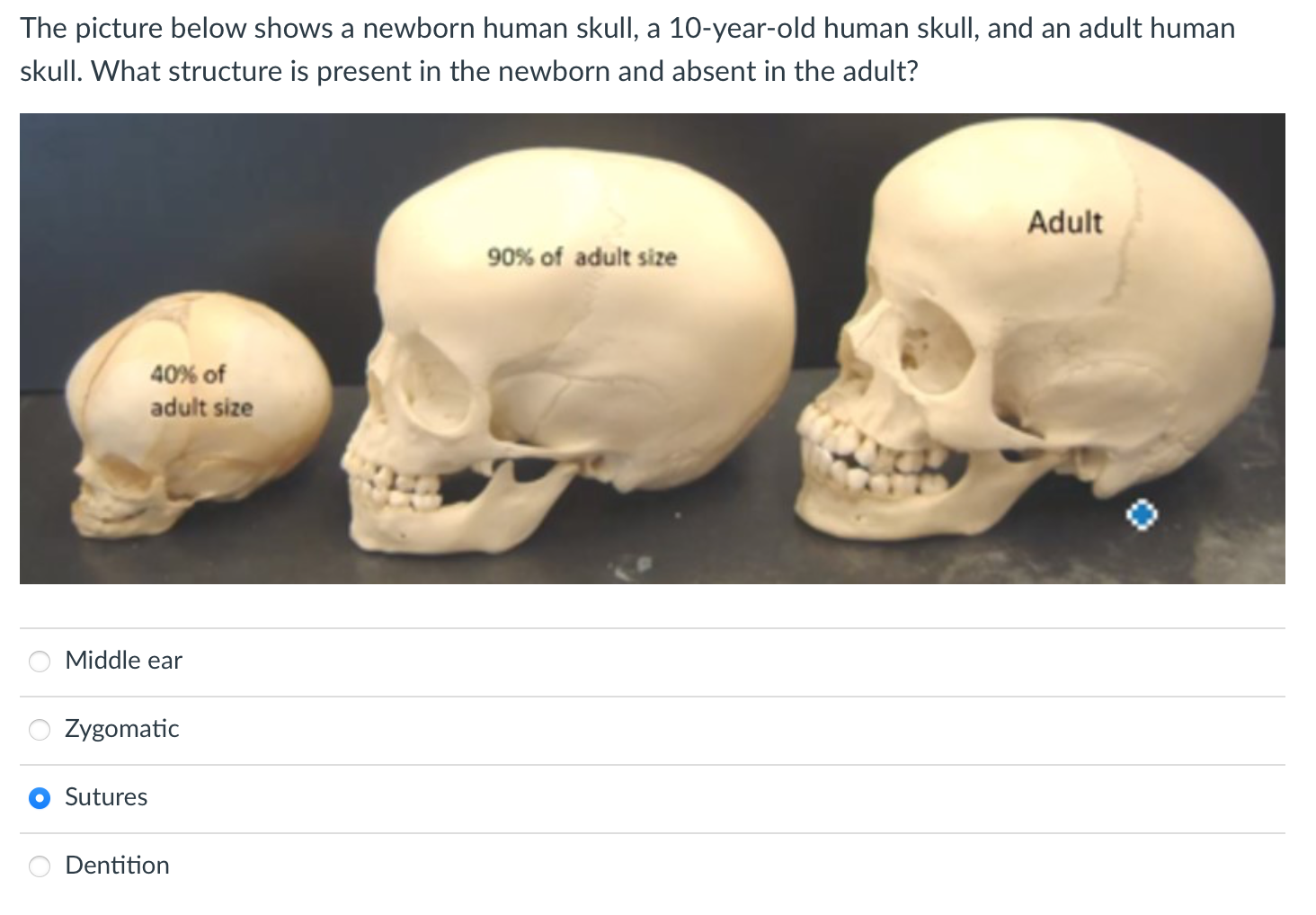 Solved The Picture Below Shows A Newborn Human Skull A Chegg