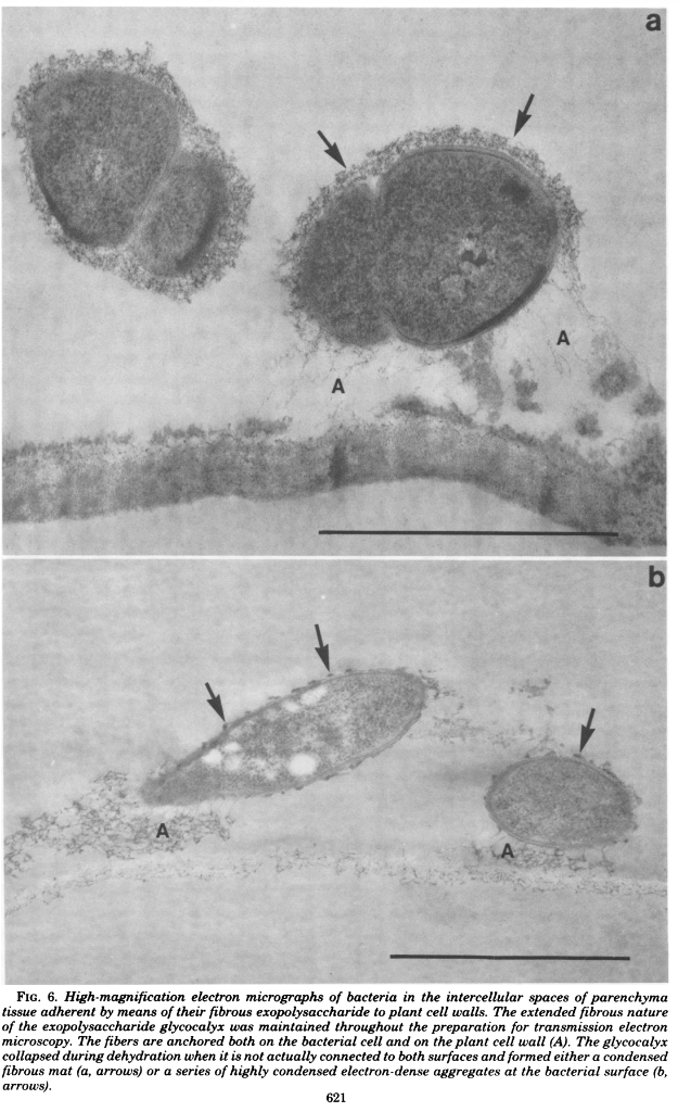 Solved The electron micrograph in Figure 6A shows cells of | Chegg.com