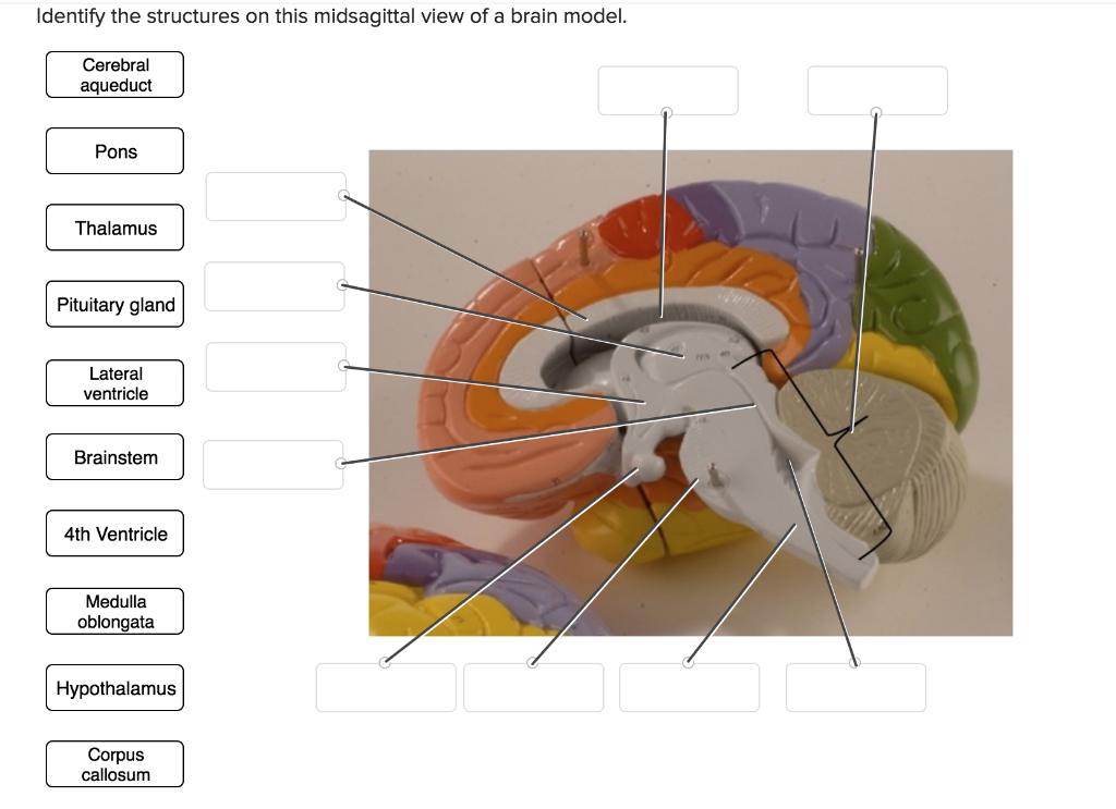 Solved Identify the structures on this midsagittal view of a | Chegg.com