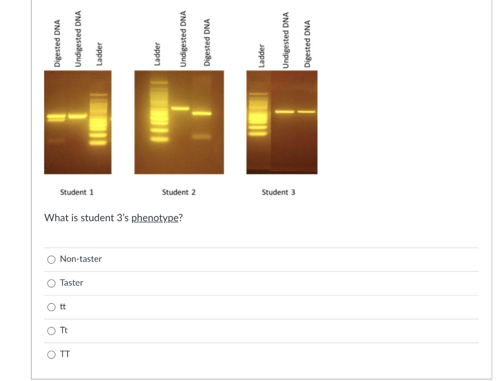Solved Digested DNA Undigested DNA Undigested DNA Digested | Chegg.com