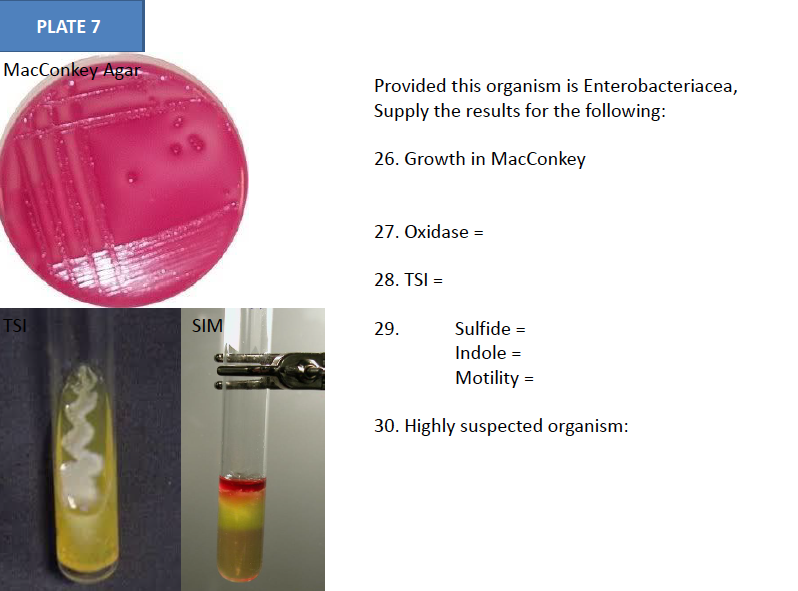 Solved PLATE 7 MacConkey Agar Provided this organism is | Chegg.com