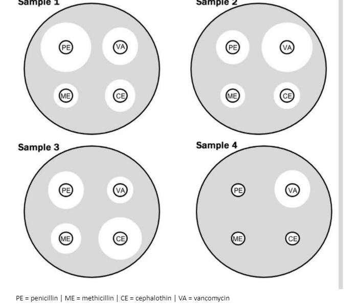 Solved Use a ruler to measure the zones of inhibition on | Chegg.com