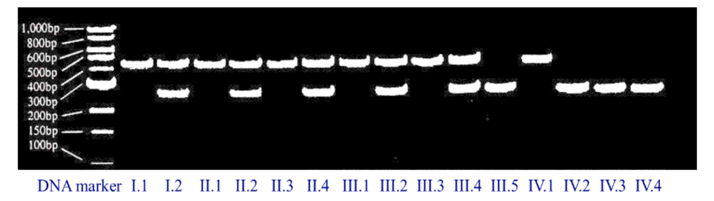 Solved Over the past few weeks we've been analysing the DMD | Chegg.com