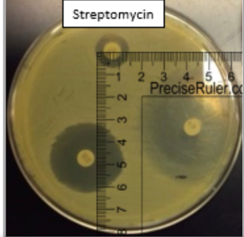 Three antibiotics discs, penicillin, streptomycin and | Chegg.com