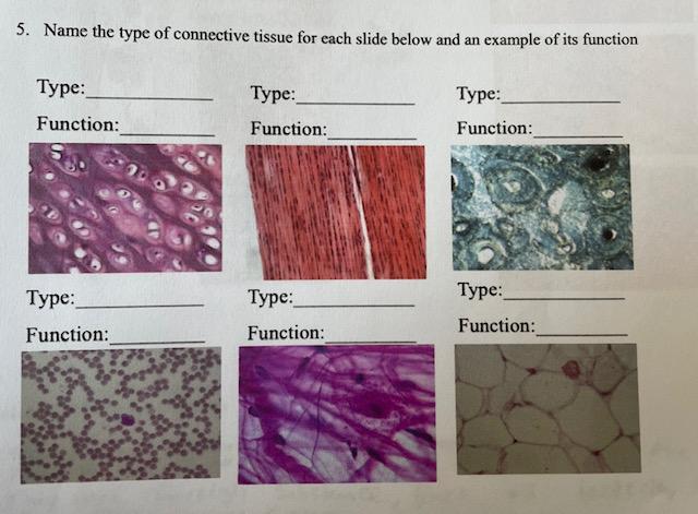 Solved 5. Name the type of connective tissue for each slide | Chegg.com