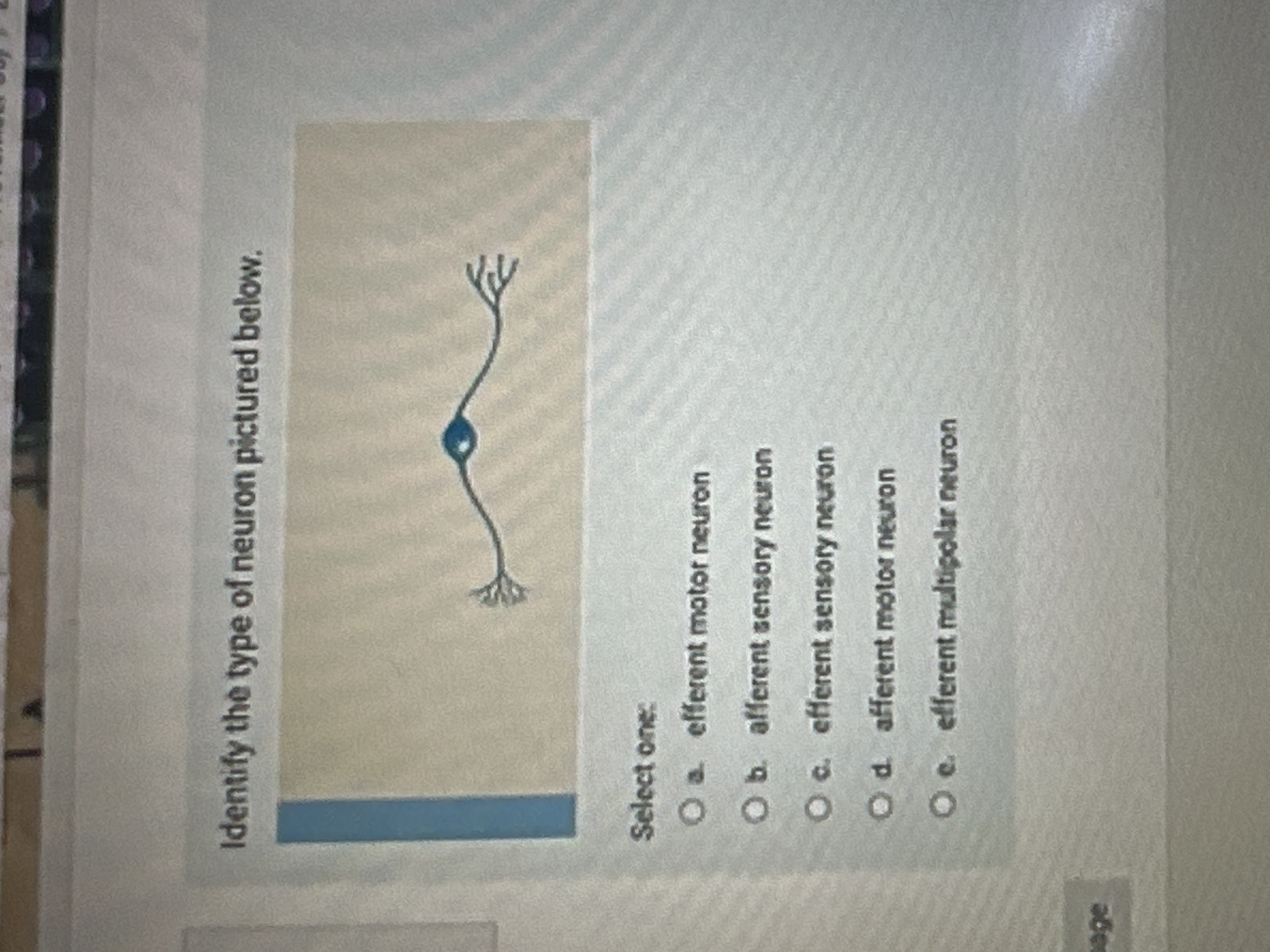 Solved Identify the type of neuron pictured below. Select | Chegg.com