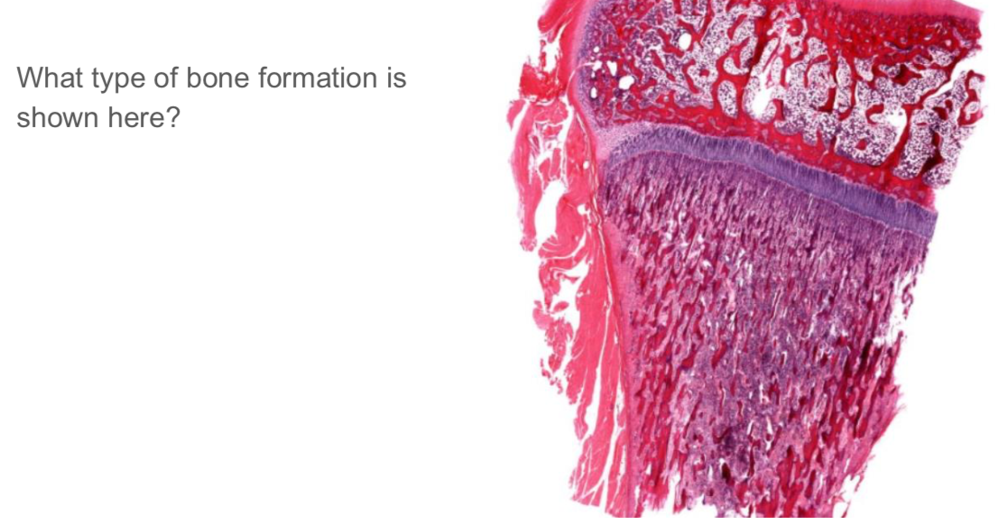 Solved What type of bone formation is shown here? | Chegg.com
