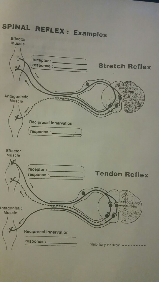 Solved SPINAL REFLEX: Examples Effector Muscle Stretch | Chegg.com