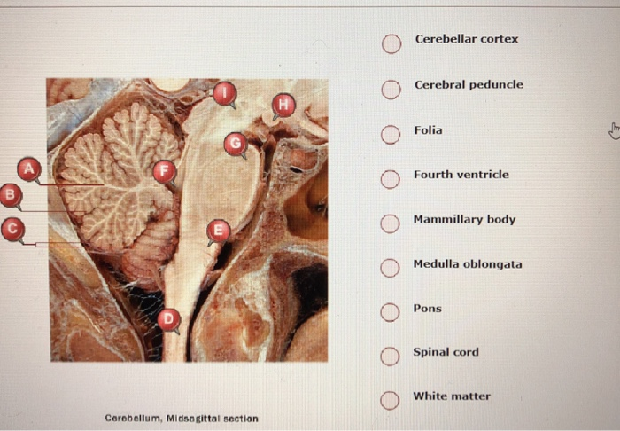 Solved O Cerebellar cortex Cerebral peduncle Folia Fourth | Chegg.com
