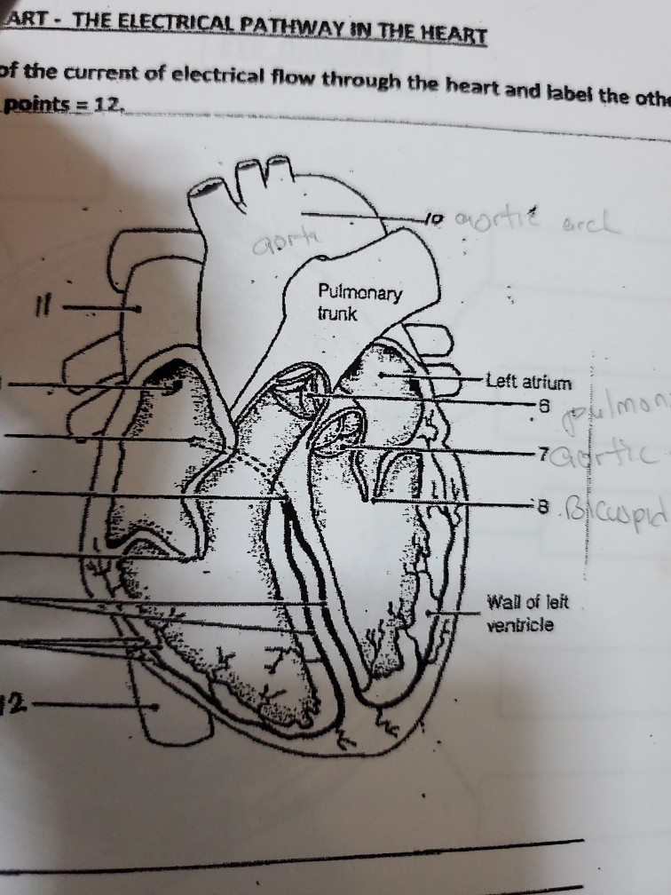 Solved ART - THE ELECTRICAL PATHWAY IN THE HEART of the | Chegg.com