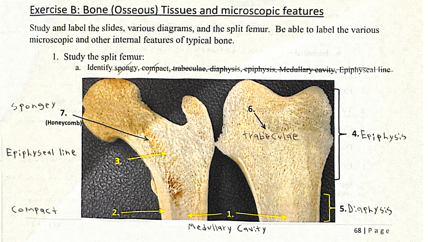 Solved Study the split femur: Identify the spongy, compact, | Chegg.com Solved Study the split femur: Identify the spongy, compact, | Chegg.com