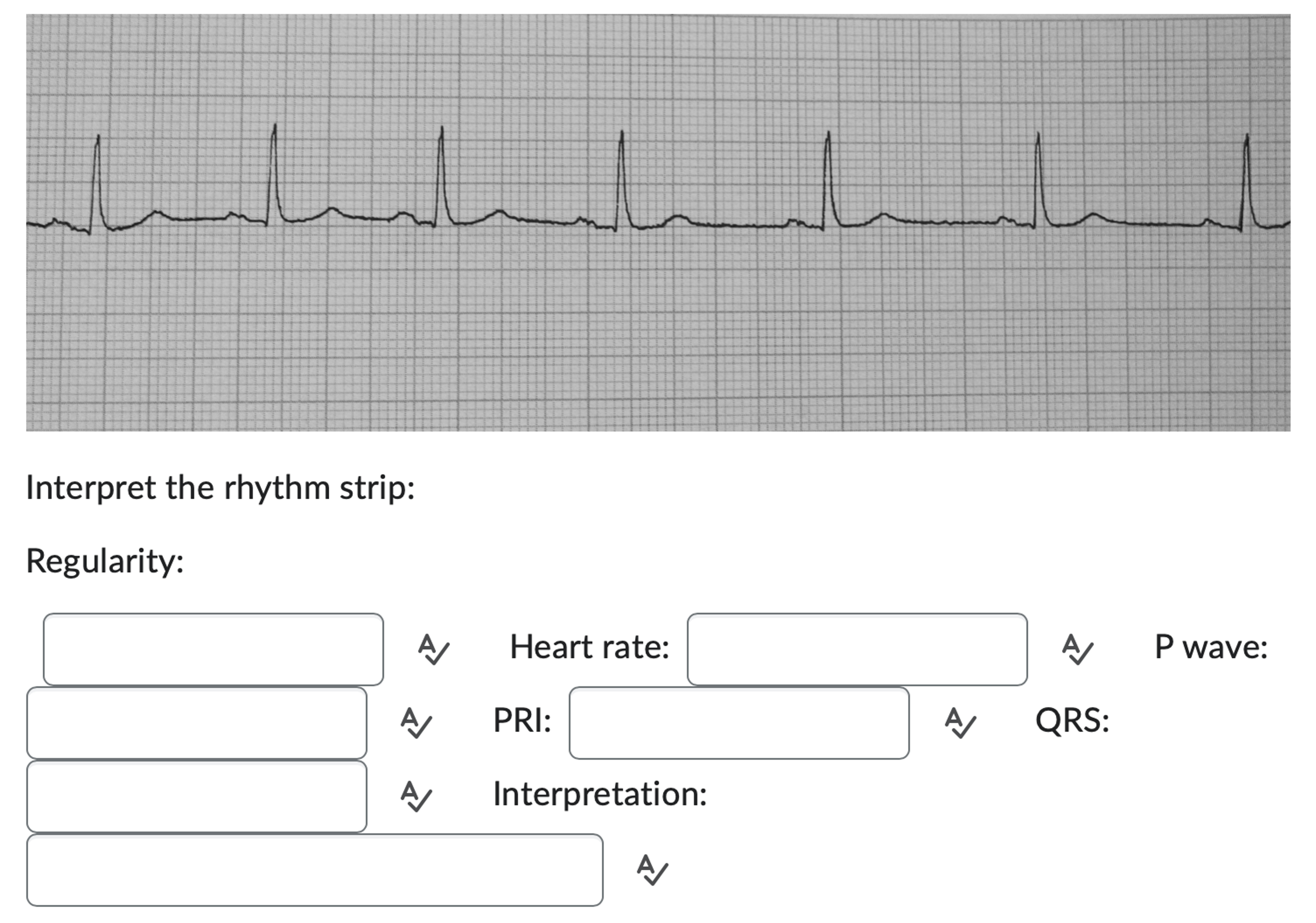 Solved Interpret the rhythm strip:Regularity: ﻿Heart rate:P | Chegg.com