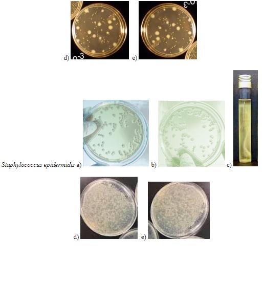 Staphylococcus Epidermidis Streak Plate