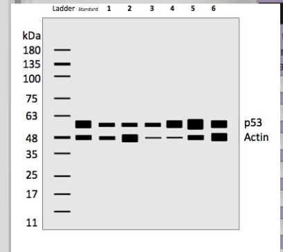 Solved Ladder standard 1 23 4 5 6 kDa 1801-一 135_ 100 75 | Chegg.com