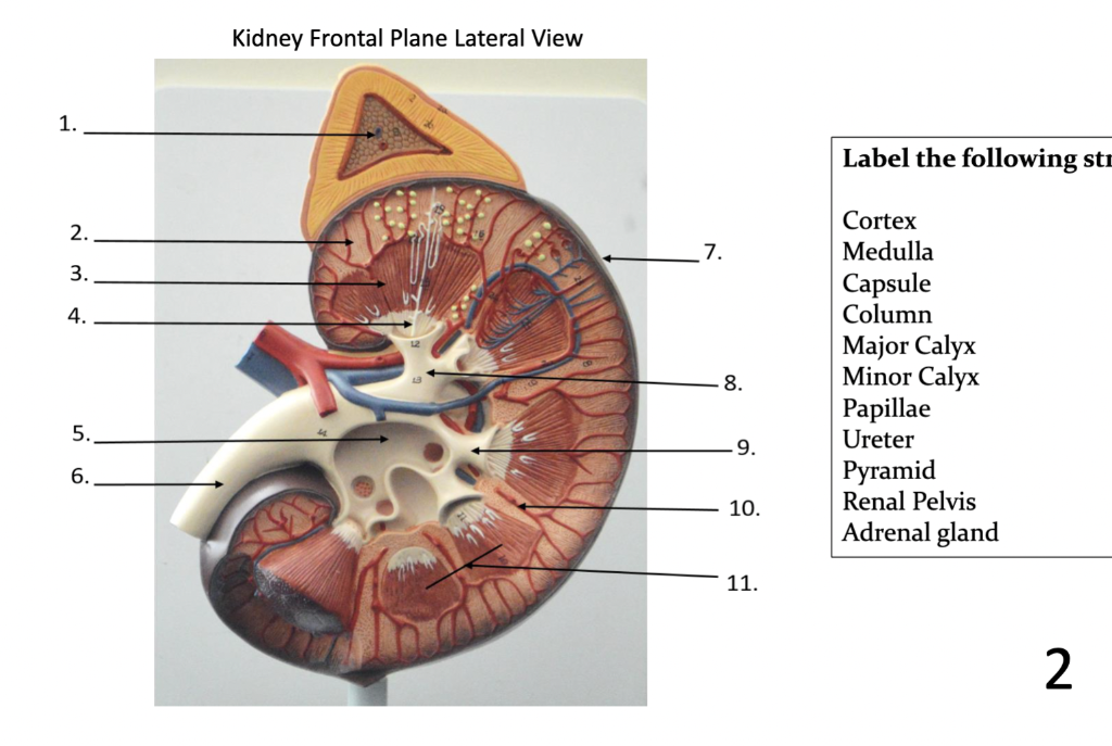 Solved Kidney Lateral View Vidnn, Crontal Dlonn I atoml | Chegg.com