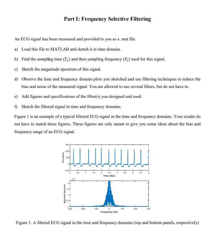 Solved Part I: Frequency Selective Filtering An ECG signal | Chegg.com