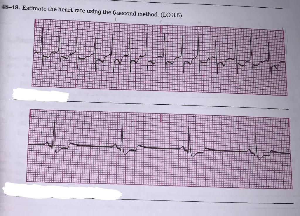 Solved 48-49. Estimate the heart rate using the 6-second | Chegg.com