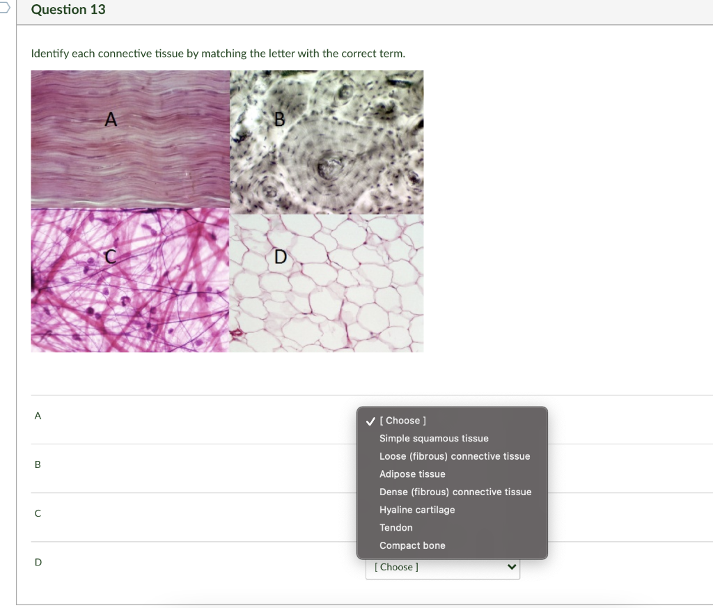 Solved Question 13 Identify each connective tissue by | Chegg.com