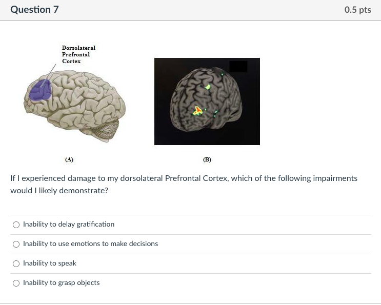 Solved Question 7 0.5 pts Dorsolateral Prefrontal Cortex If | Chegg.com