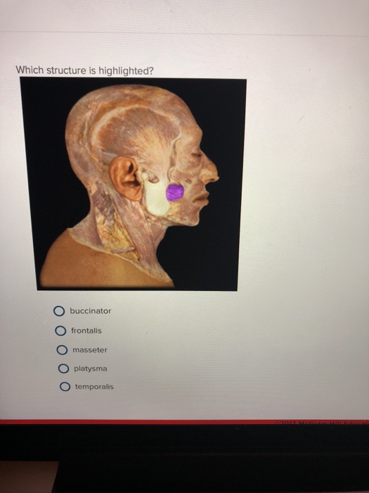 Solved Which structure is highlighted? O buccinator O | Chegg.com