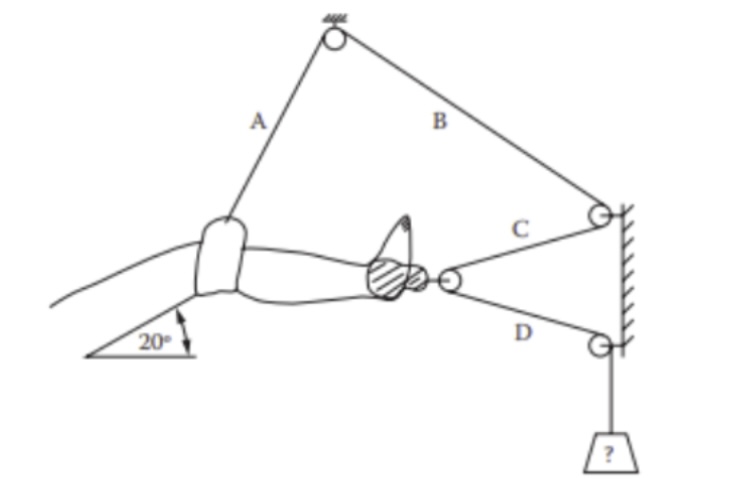 Solved A Russell traction (shown below) is used for | Chegg.com