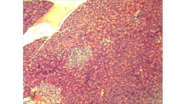 Solved From the Pancreas: Recognize slide at low, medium, | Chegg.com