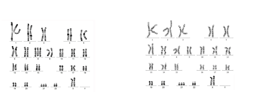Solved Karyotypes were obtained for a total of 30 cells. | Chegg.com