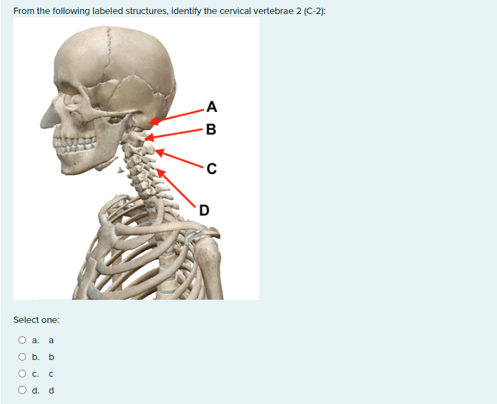 Solved From the following labeled structures, identify the | Chegg.com