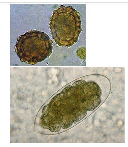 Solved Parasite Case Study #4 A mother brought the parasite | Chegg.com