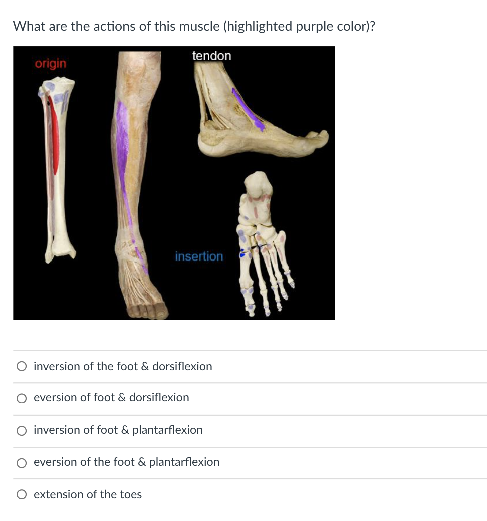 Solved What are the actions of this muscle (highlighted | Chegg.com