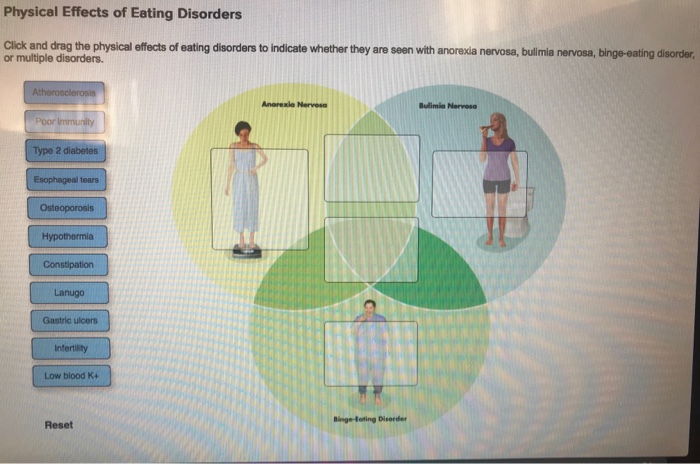 Solved Physical Effects of Eating Disorders Click and drag | Chegg.com