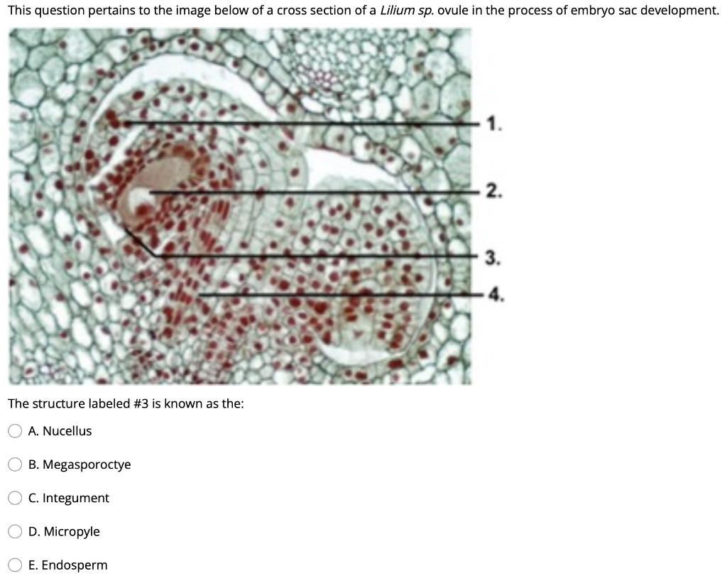 Solved The structure labeled \#3 is known as the: A. | Chegg.com