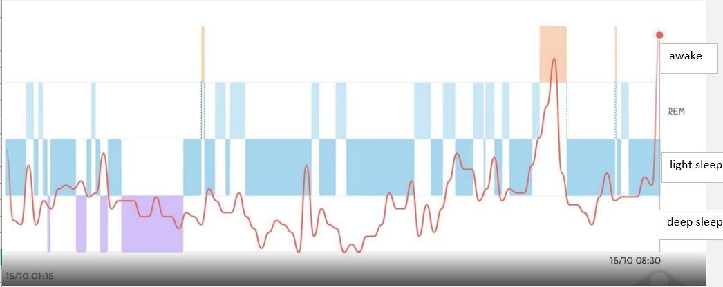 Solved This is the graph of sleep cycle of the | Chegg.com